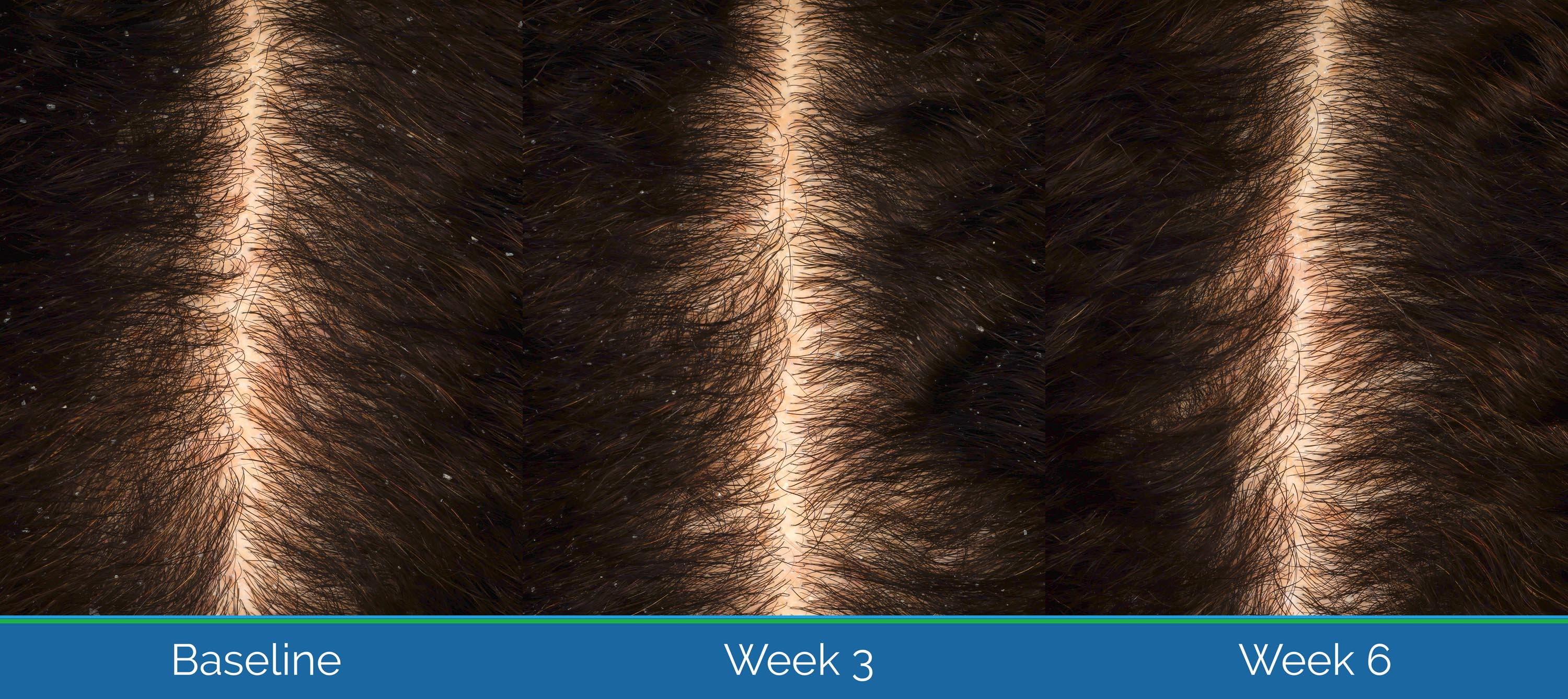 Testing Tactics: Approaches to Measure Scalp Comfort and Care ...