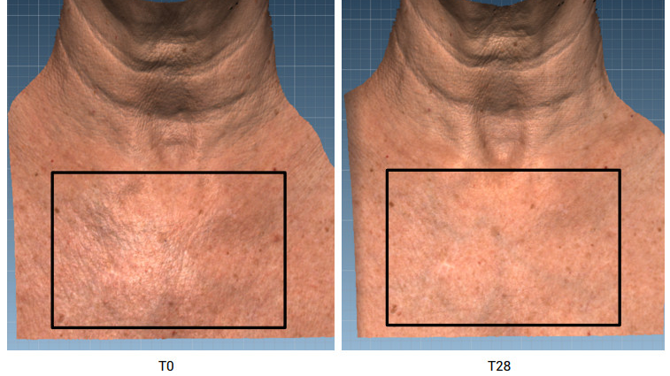 Chemyunion's Upcycled Eccofia Citrus Rejuvenates Neck, Décolleté Skin ...