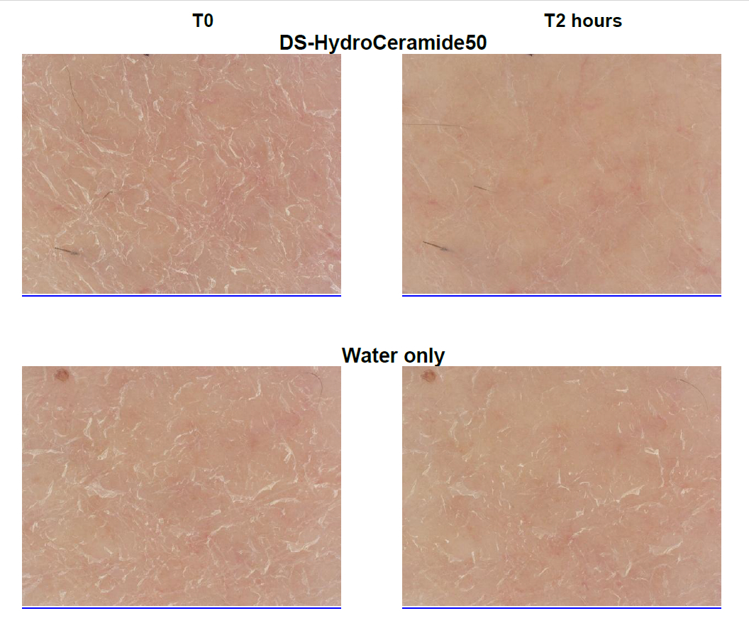 Croda Beauty Launches DS-HydroCeramide50 and 50S to Enhance Skin ...